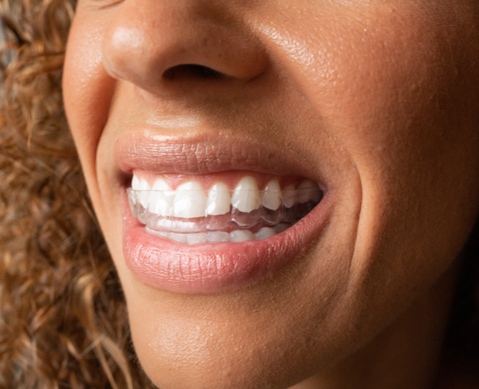 5 Reasons Why People Are Choosing Retainers Direct