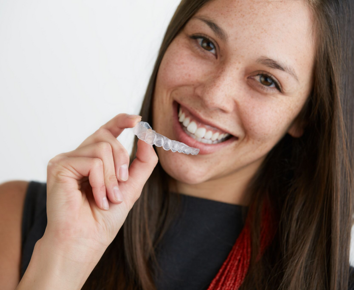 5 Reasons Why People Are Choosing Retainers Direct